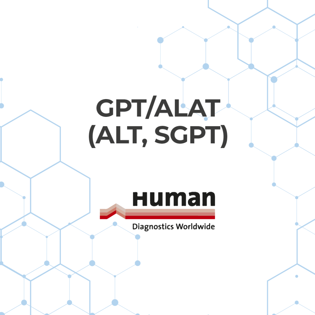 GPT/ALAT (ALT, SGPT) – Comprolab