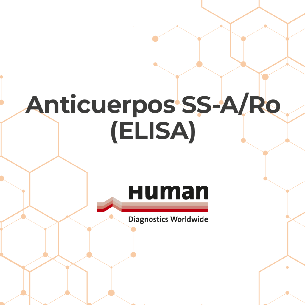 Anticuerpos SS-A/Ro (ELISA) – Comprolab